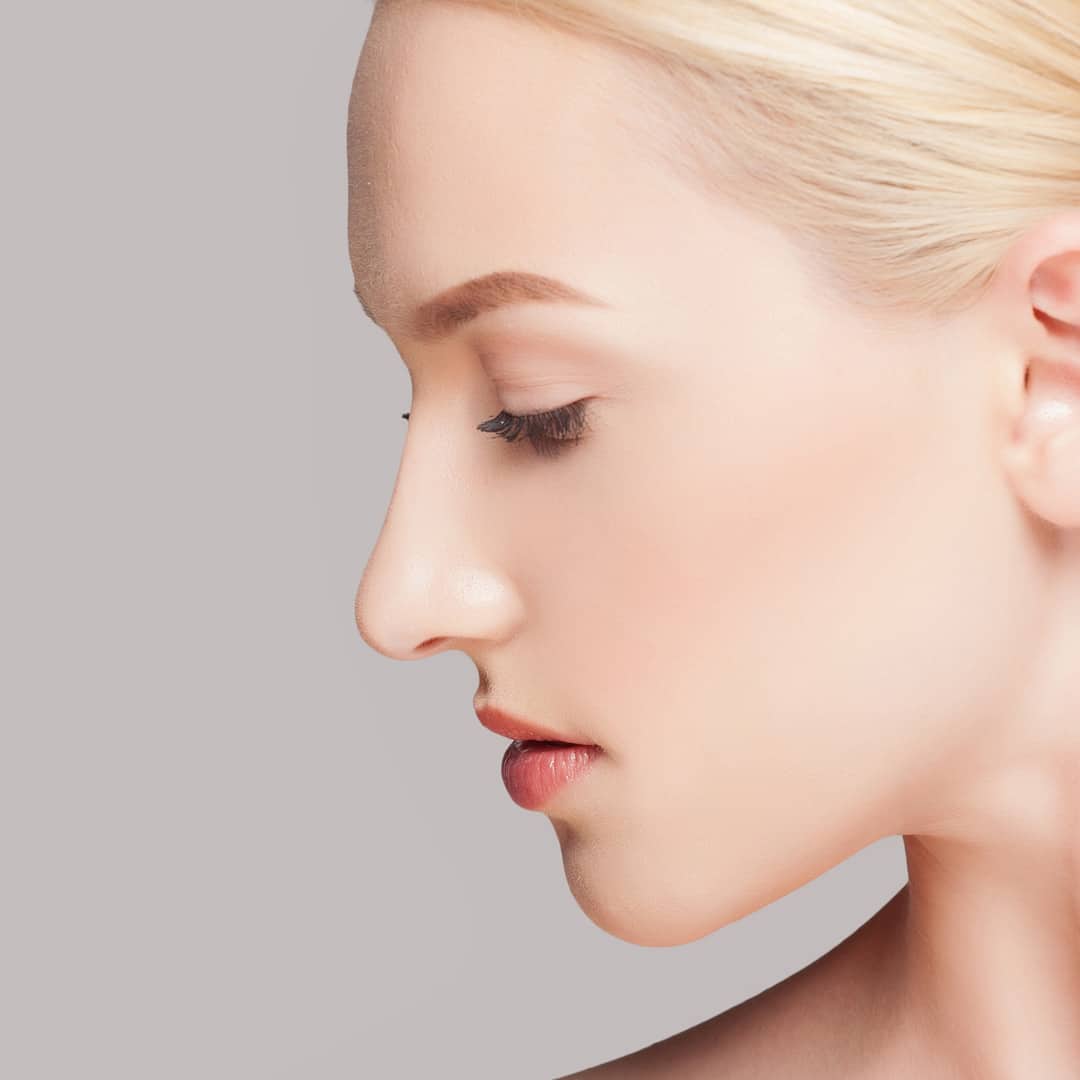What is External Rhinoplasty? - Philip Miller MD